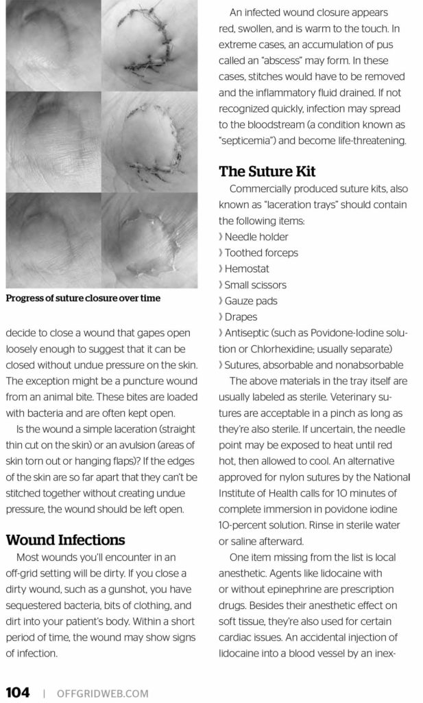 Diy Survival Best Hacks For Worst Case Scenarios Gundigest Store